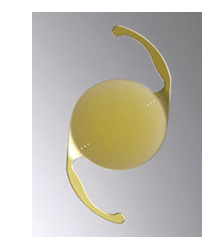 Toric Lenses for Correcting Astigmatism in Cataract Surgery - Axis Eye ...